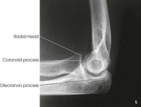 Merrill's Atlas of Radiographic Positioning & Procedures