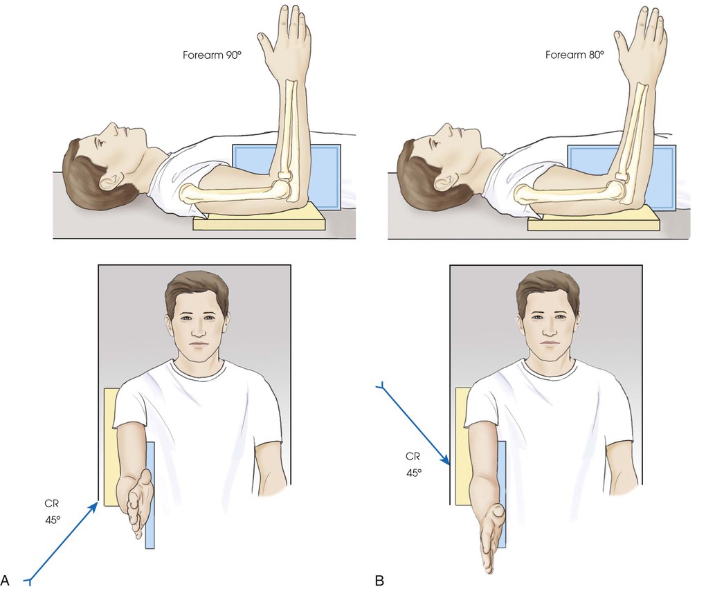 Merrill's Atlas of Radiographic Positioning & Procedures