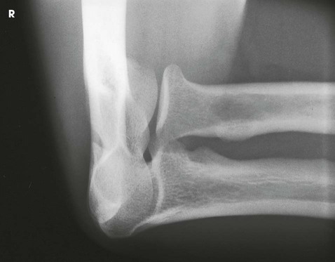 Merrill's Atlas of Radiographic Positioning & Procedures