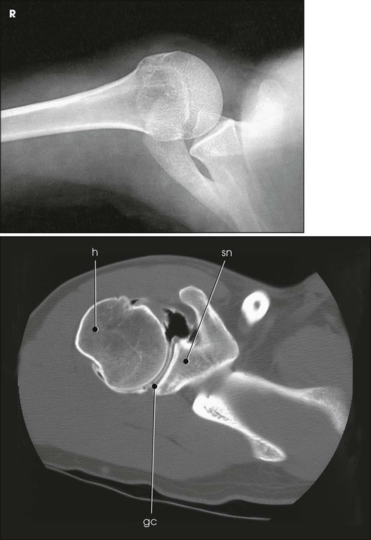 Merrill's Atlas of Radiographic Positioning & Procedures
