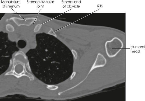 Merrill's Atlas of Radiographic Positioning & Procedures
