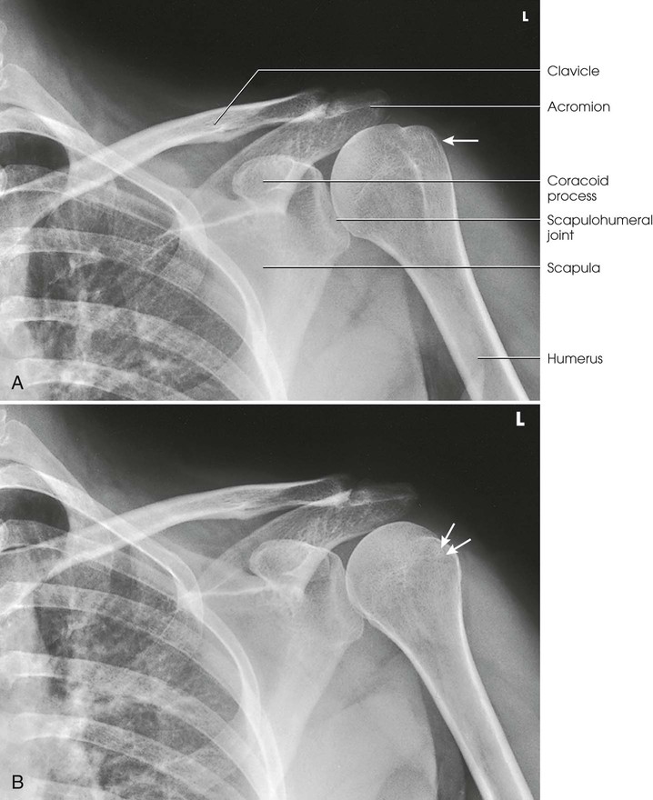 Merrill's Atlas of Radiographic Positioning & Procedures