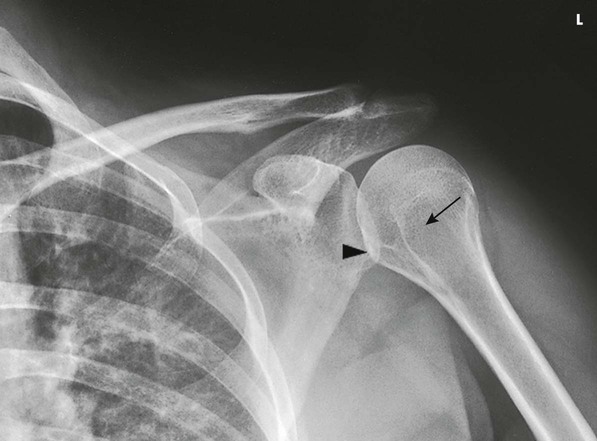 Merrill's Atlas of Radiographic Positioning & Procedures