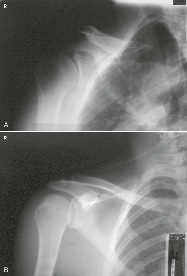 Merrill's Atlas of Radiographic Positioning & Procedures