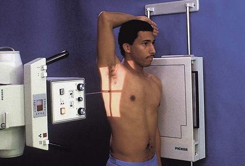 Merrill's Atlas of Radiographic Positioning & Procedures