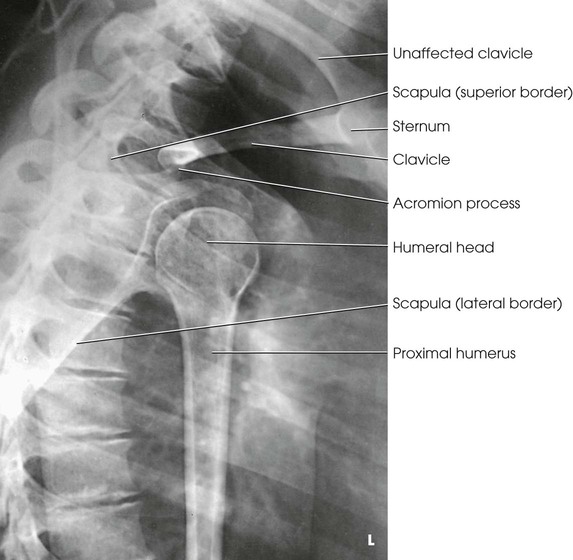 Merrill's Atlas of Radiographic Positioning & Procedures