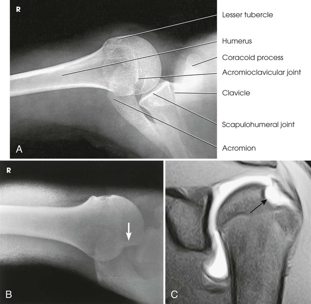 Merrill's Atlas of Radiographic Positioning & Procedures