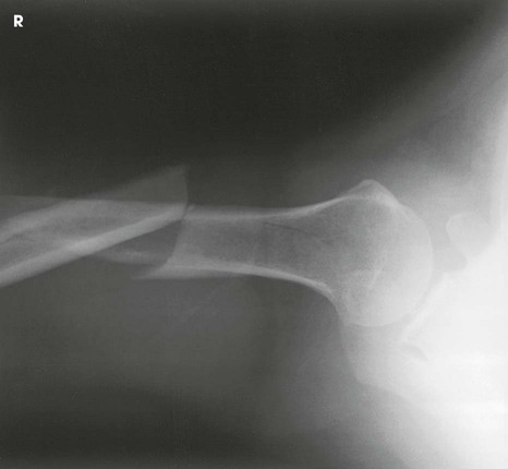 Merrill's Atlas of Radiographic Positioning & Procedures