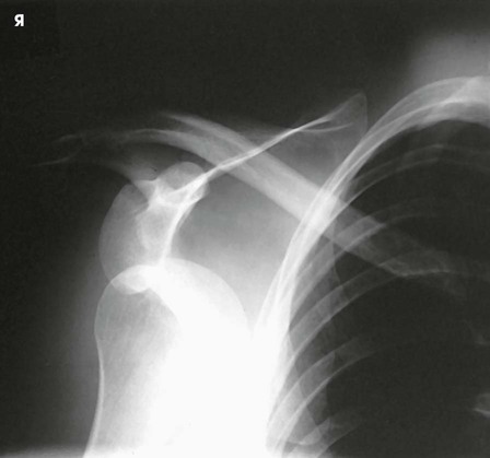 Merrill's Atlas of Radiographic Positioning & Procedures