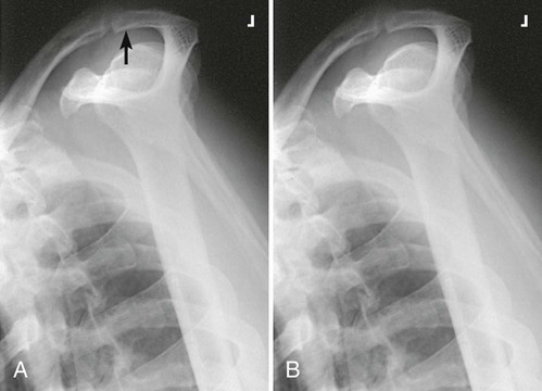 Merrill's Atlas of Radiographic Positioning & Procedures
