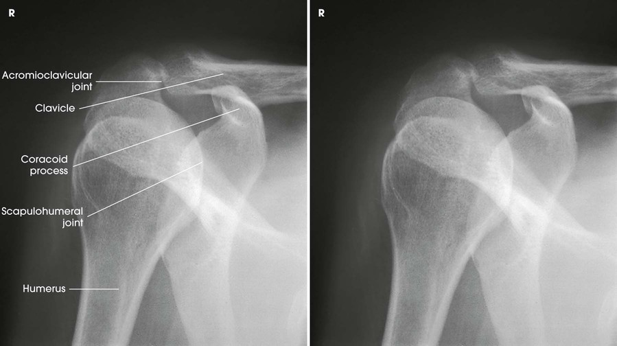 Merrill's Atlas of Radiographic Positioning & Procedures