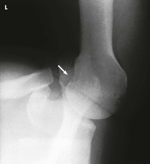 Merrill's Atlas of Radiographic Positioning & Procedures