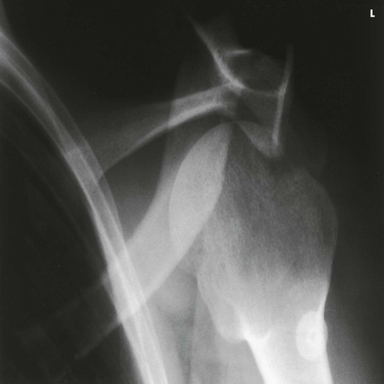 Merrill's Atlas of Radiographic Positioning & Procedures