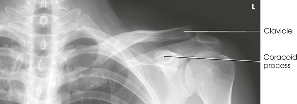 Merrill's Atlas of Radiographic Positioning & Procedures