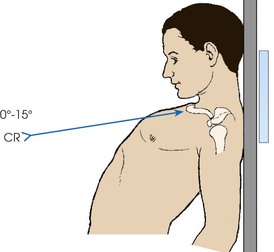 Merrill's Atlas of Radiographic Positioning & Procedures