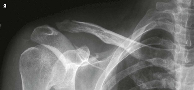 Merrill's Atlas of Radiographic Positioning & Procedures