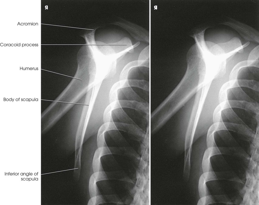 Merrill's Atlas of Radiographic Positioning & Procedures
