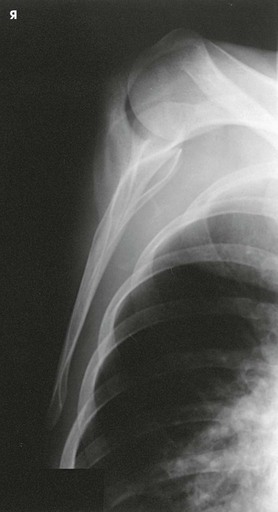 Merrill's Atlas of Radiographic Positioning & Procedures