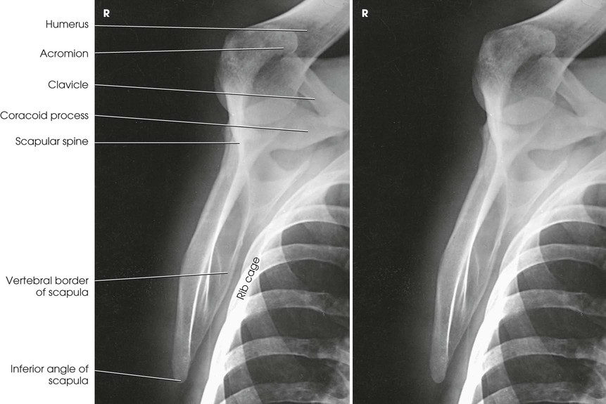 Merrill's Atlas of Radiographic Positioning & Procedures
