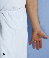 Merrill's Atlas of Radiographic Positioning & Procedures