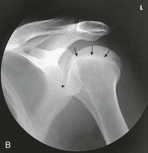 Merrill's Atlas of Radiographic Positioning & Procedures