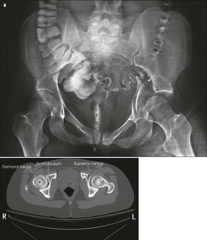 Merrill's Atlas of Radiographic Positioning & Procedures