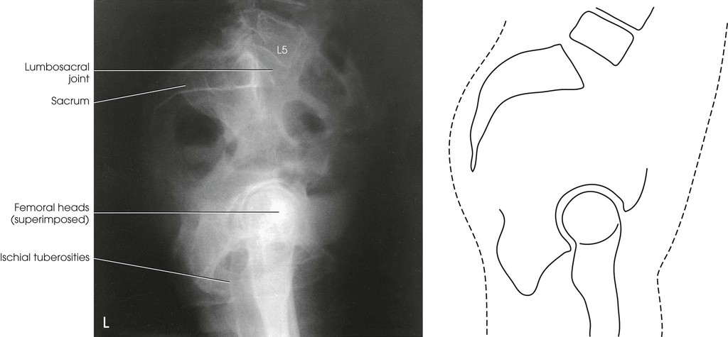 Merrill's Atlas of Radiographic Positioning & Procedures