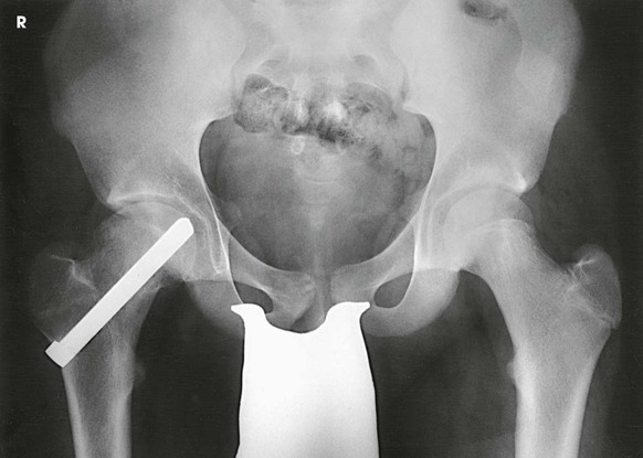 Merrill's Atlas of Radiographic Positioning & Procedures