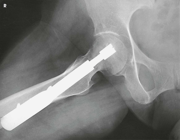 Merrill's Atlas of Radiographic Positioning & Procedures