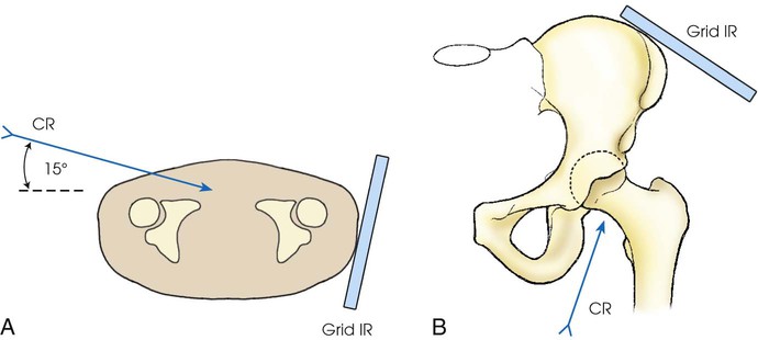 Merrill's Atlas of Radiographic Positioning & Procedures