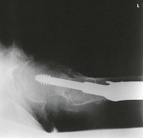 Merrill's Atlas of Radiographic Positioning & Procedures