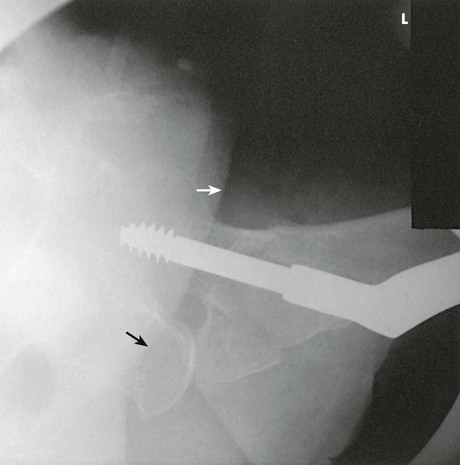 Merrill's Atlas of Radiographic Positioning & Procedures