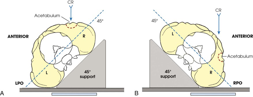 Merrill's Atlas of Radiographic Positioning & Procedures