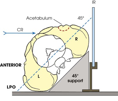 Merrill's Atlas of Radiographic Positioning & Procedures