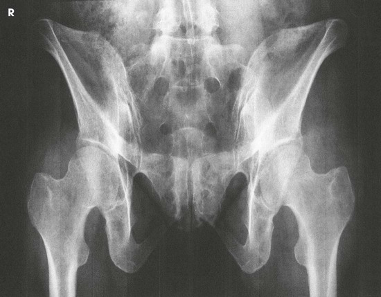 Merrill's Atlas of Radiographic Positioning & Procedures