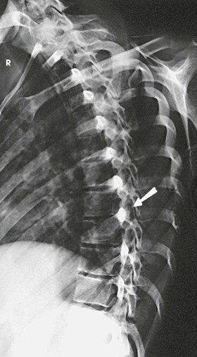 Merrill's Atlas of Radiographic Positioning & Procedures
