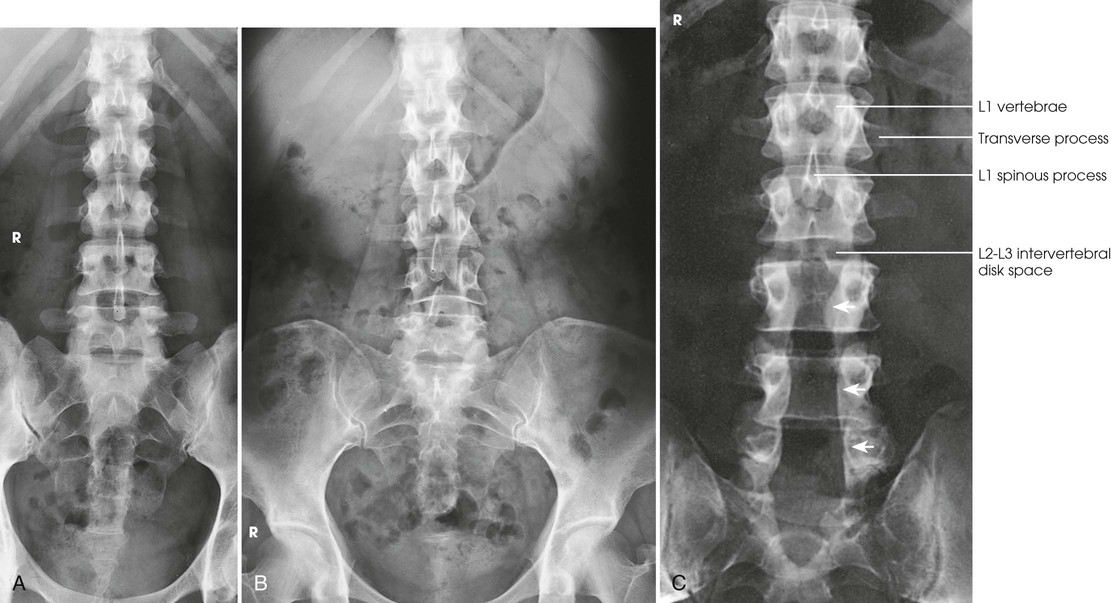 Merrill's Atlas of Radiographic Positioning & Procedures