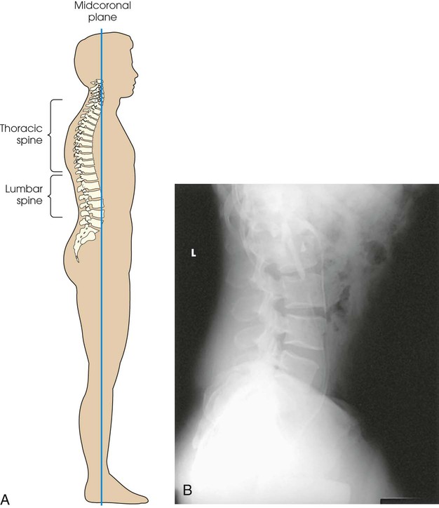 Merrill's Atlas of Radiographic Positioning & Procedures