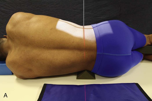 Merrill's Atlas of Radiographic Positioning & Procedures