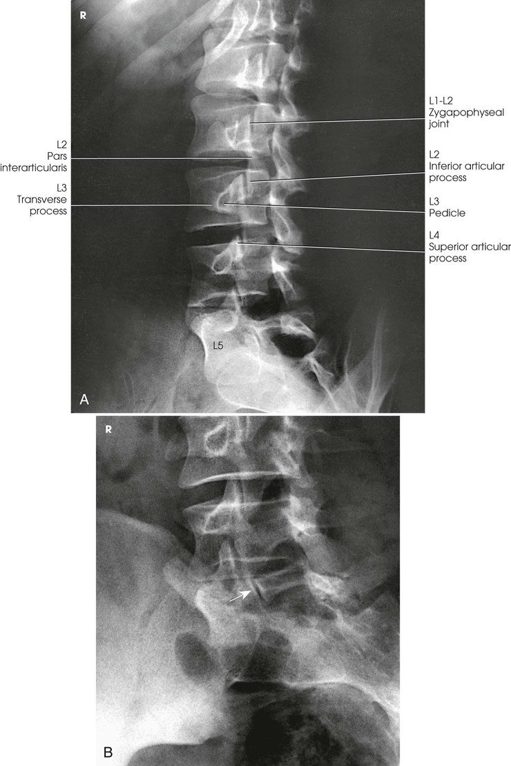 Merrill's Atlas of Radiographic Positioning & Procedures