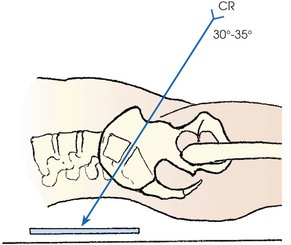 Merrill's Atlas of Radiographic Positioning & Procedures