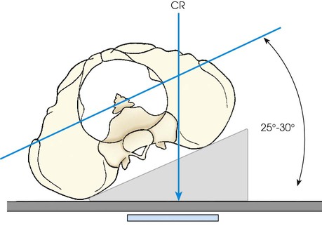 Merrill's Atlas of Radiographic Positioning & Procedures