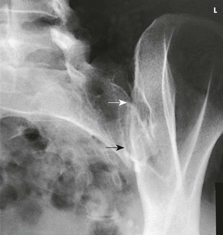 Merrill's Atlas of Radiographic Positioning & Procedures