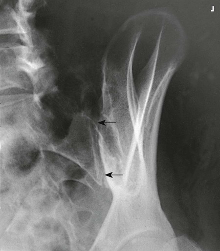 Merrill's Atlas of Radiographic Positioning & Procedures