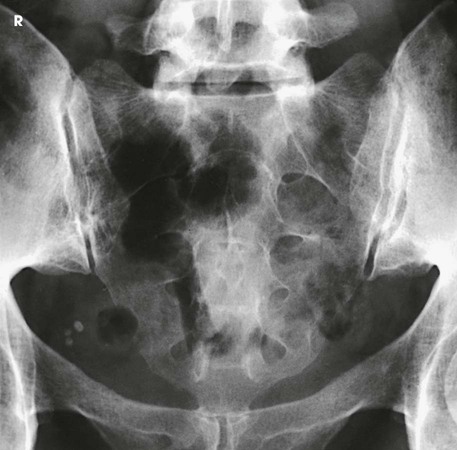Merrill's Atlas of Radiographic Positioning & Procedures