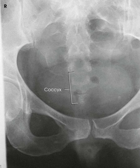 Merrill's Atlas of Radiographic Positioning & Procedures