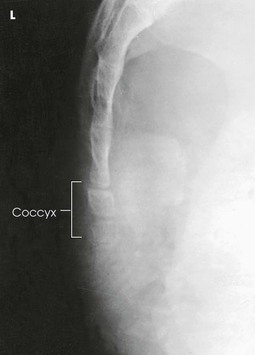 Merrill's Atlas of Radiographic Positioning & Procedures