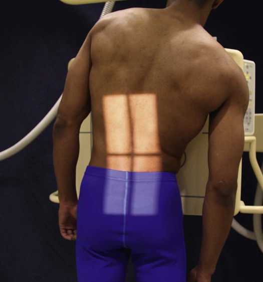 Merrill's Atlas of Radiographic Positioning & Procedures