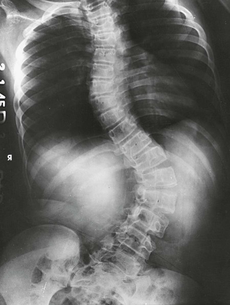 Merrill's Atlas of Radiographic Positioning & Procedures