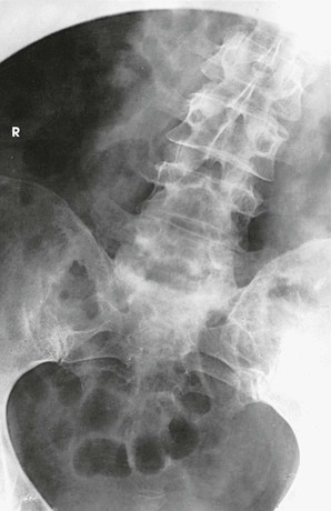 Merrill's Atlas of Radiographic Positioning & Procedures